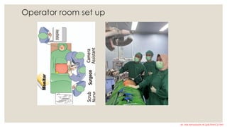 LAPAROSCOPY TAPP HERNIA inguinal ( tehnik operasi ) azis | PPTX