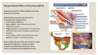 LAPAROSCOPY TAPP HERNIA inguinal ( tehnik operasi ) azis | PPTX