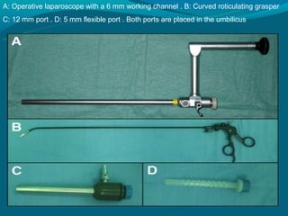 Laparoscopy Transportation using Magnets and Tramways | PPT
