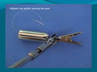 Laparoscopy Transportation using Magnets and Tramways | PPT