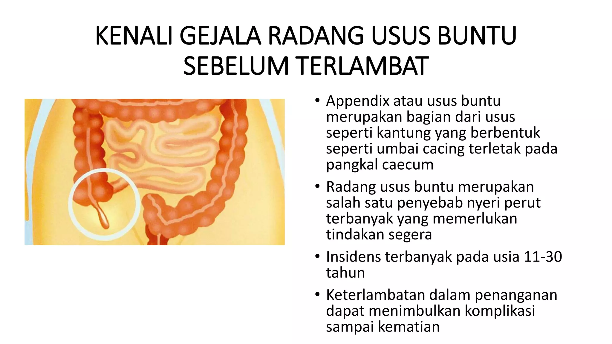 Laparoskopi Appendectomy Single Hole omni.pptx