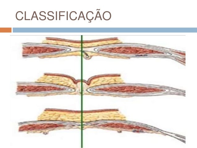 Laparotomia e fechamento