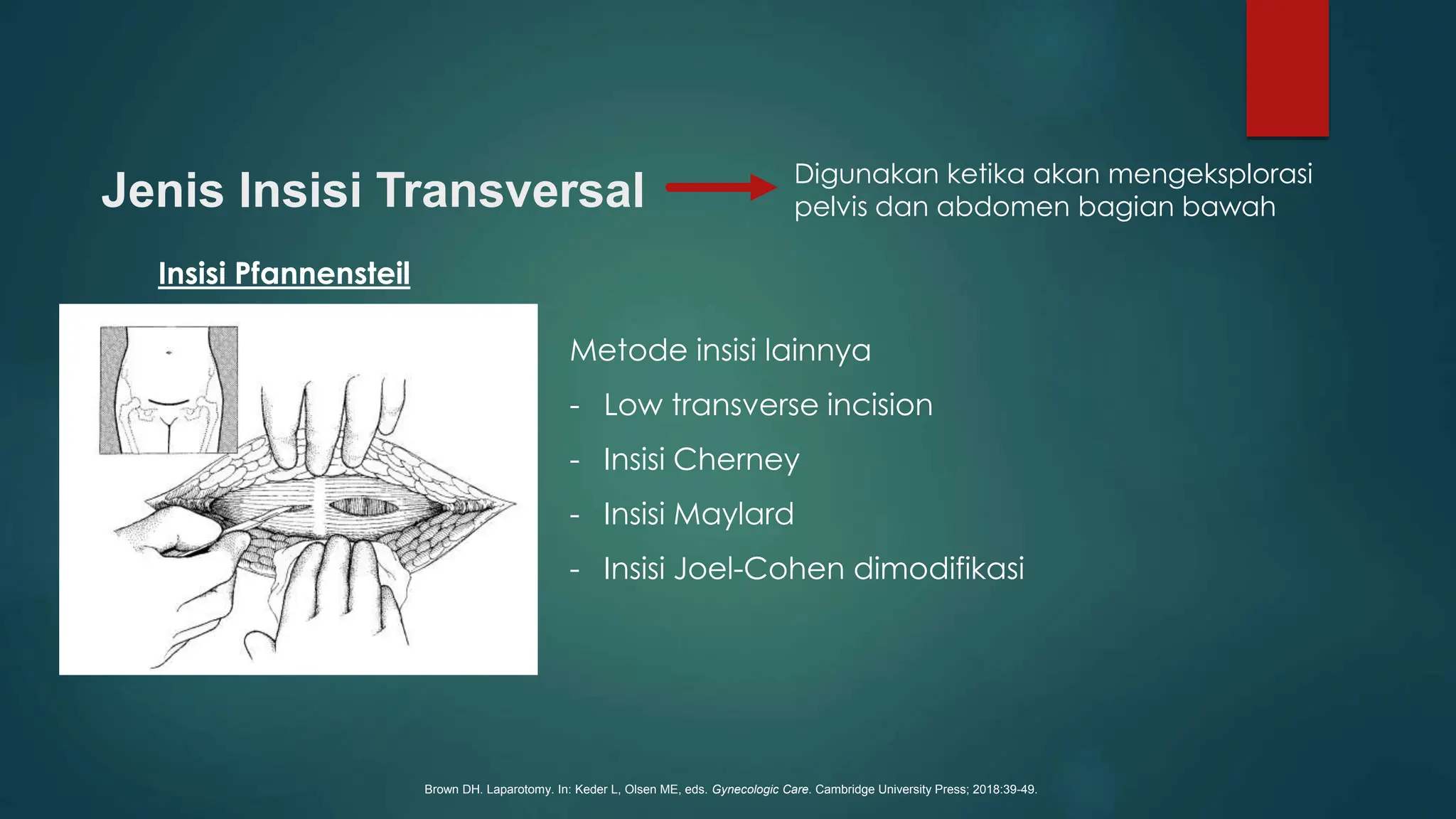 LAPAROTOMI EKSPLORASI YANG BISA DIPELAJARI | PPTX