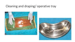 Laparotomy – opening and closing | PPTX