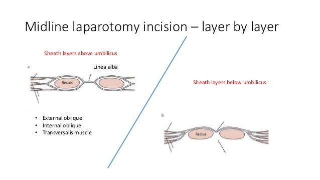Laparotomy – opening and closing
