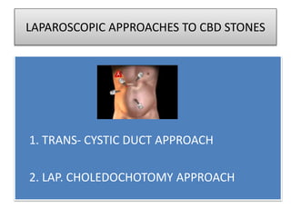 LAP CBD ppt | PPTX