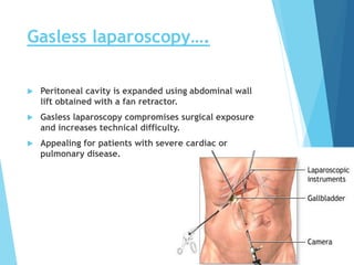 anaesthesia for lap cholecystectomy | PPTX