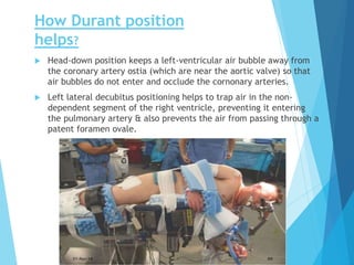 anaesthesia for lap cholecystectomy | PPTX