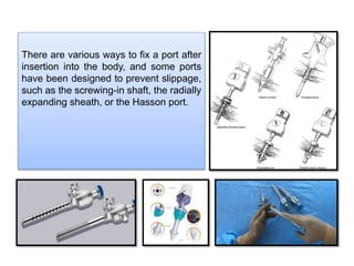 laparoscopic ergonomics.pptx