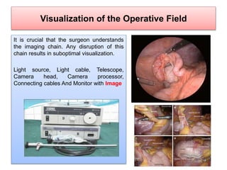 laparoscopic ergonomics.pptx