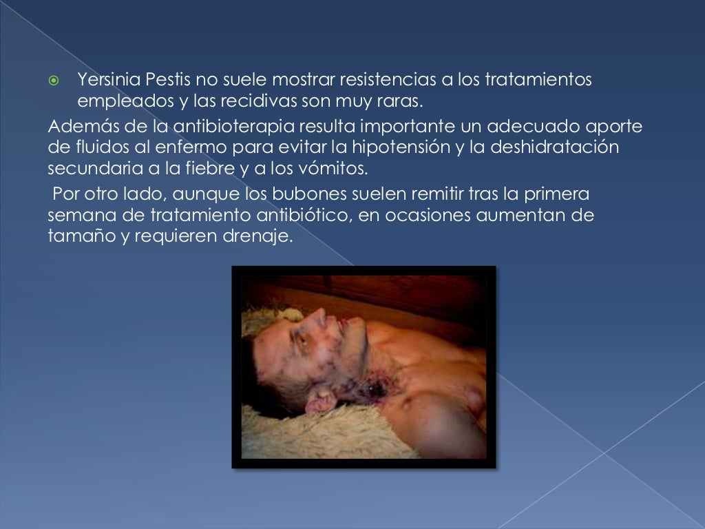 La peste bubónica 2