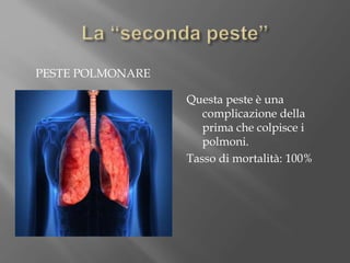 La peste (pres. storia) | PPTX | Infectious Diseases | Diseases and ...