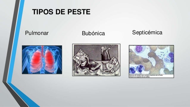 La peste y la practica medica