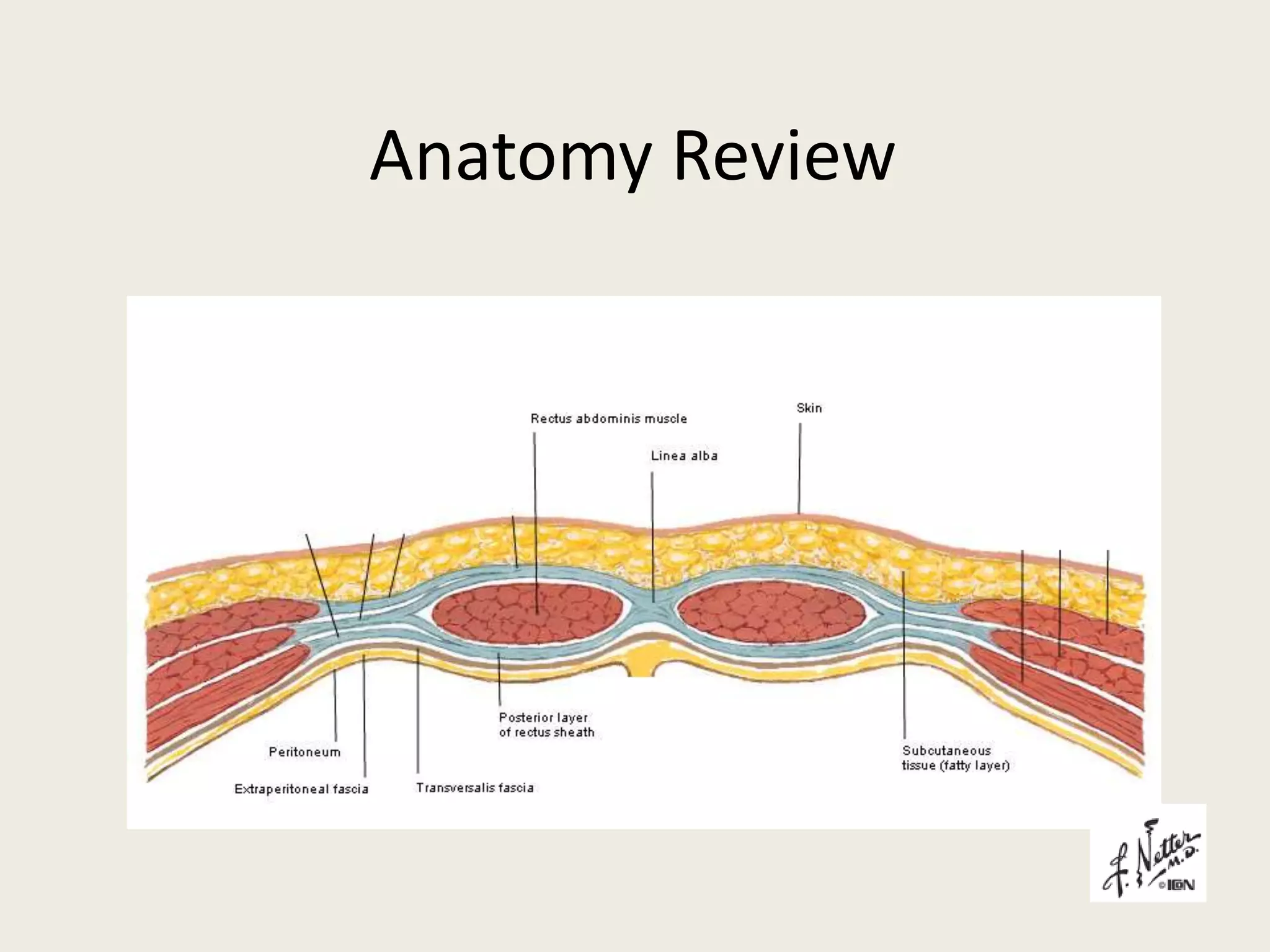 Laparoscopic inguinal hernia repair (TAPP) | PPTX