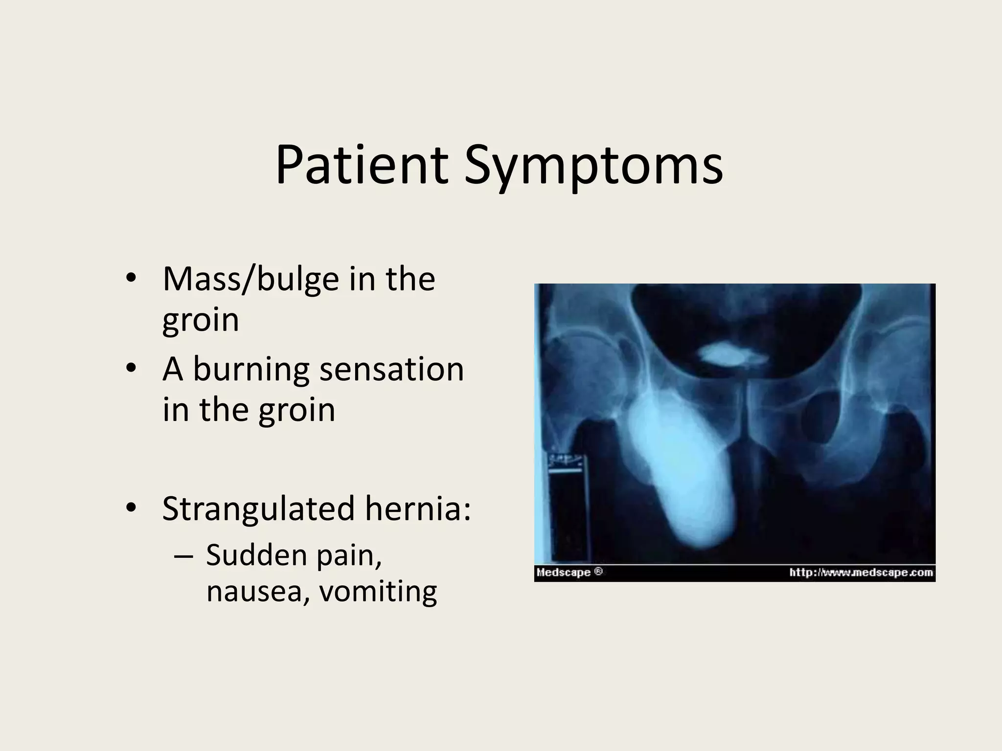 Laparoscopic inguinal hernia repair (TAPP) | PPTX