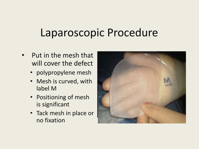 Laparoscopic inguinal hernia repair (TAPP) | PPTX