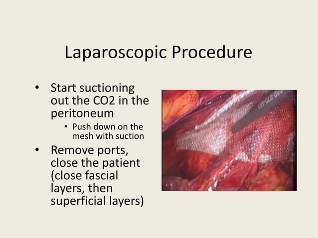 Laparoscopic inguinal hernia repair (TAPP) | PPTX