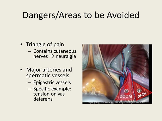 Laparoscopic inguinal hernia repair (TAPP)