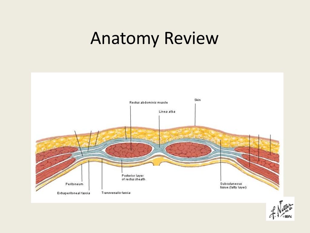 Laparoscopic inguinal hernia repair (TAPP)