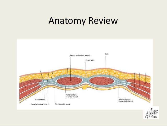Laparoscopic inguinal hernia repair (TAPP)