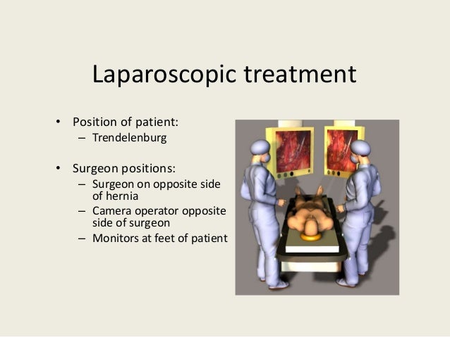Laparoscopic Inguinal Hernia Repair Tapp