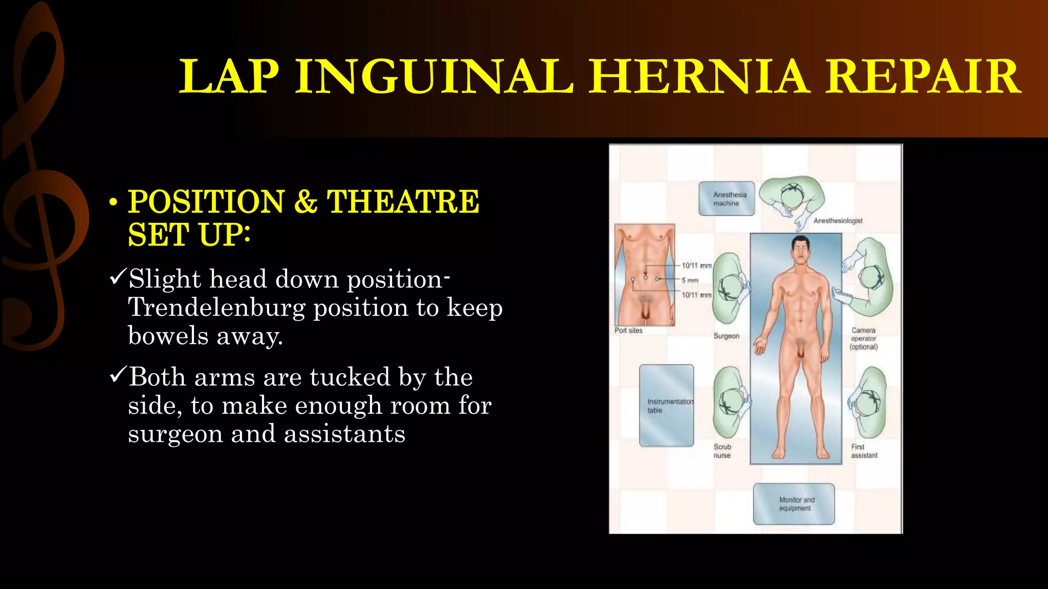 Lap inguinal hernia repair/ operative surgery | PPTX