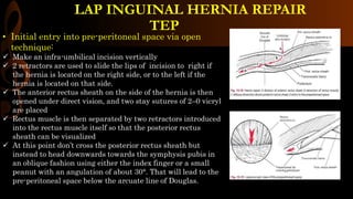 Lap inguinal hernia repair/ operative surgery | PPTX