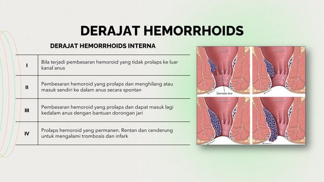 LAPKAS HEMOROID.pdf