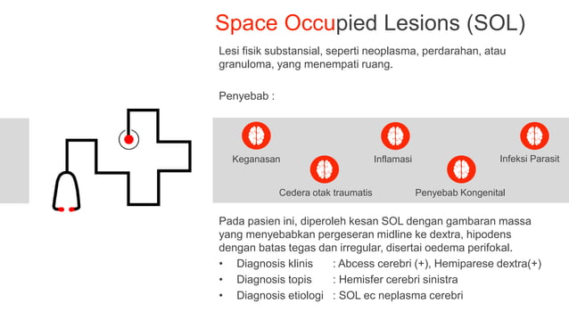 LAPKAS Px Ny. S - SOL-Abscess Cerebri - Shafira K.W_I4061192016.pptx