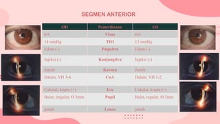 Laporan kasus divisi - Refraksi presbipia | PPTX