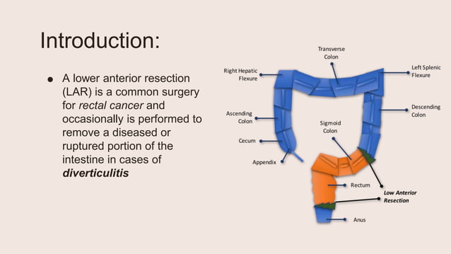 Laparoscopic Low Anterior resection.pptx | Digestive Disorders ...