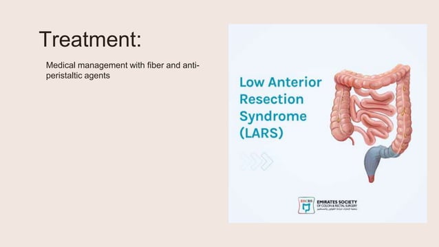 Laparoscopic Low Anterior resection.pptx | Digestive Disorders | Diseases and Conditions
