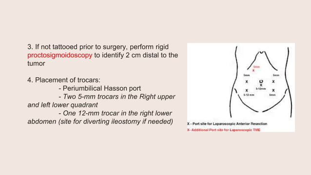 Laparoscopic Low Anterior resection.pptx | Digestive Disorders ...