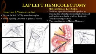 LAP LEFT HEMICOLECTOMY-STEP BY STEP Operative Surgery.pptx