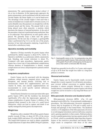 LAPAROSCOPIC SURGERY FOR MORBID OBESITY | PDF