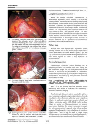 LAPAROSCOPIC SURGERY FOR MORBID OBESITY | PDF