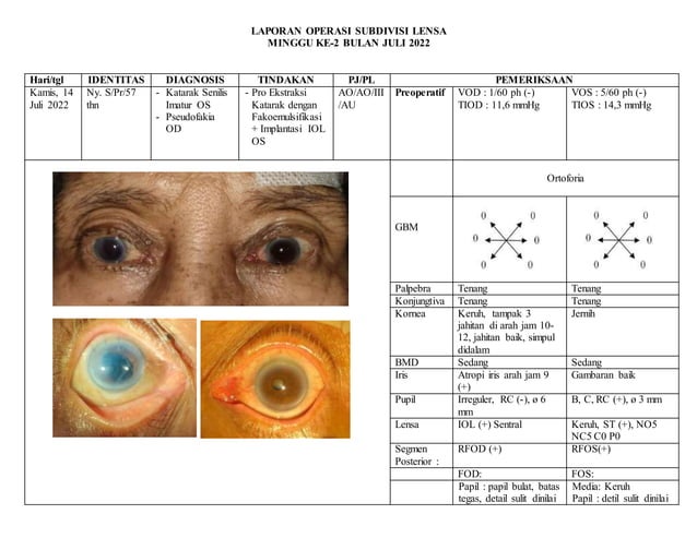 LapOp Ny S Subdiv Lensa.docx