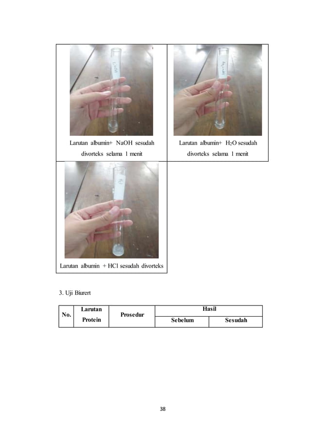 Laporan Biokimia Praktikum Protein: Uji Unsur-Unsur Protein, Uji ...