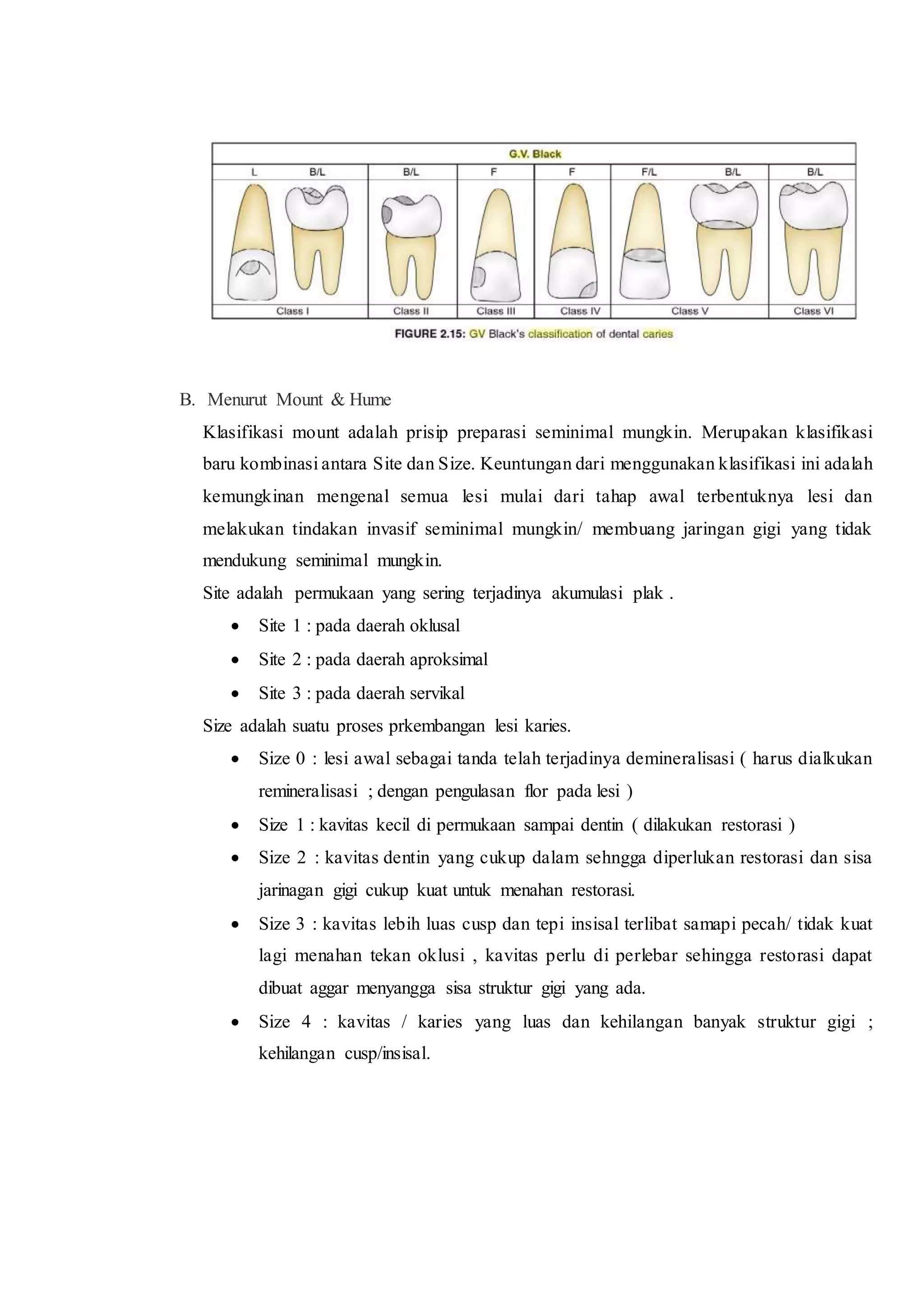 karies gigi. pemeriksaan penunjang dan tes vitalitas | DOCX