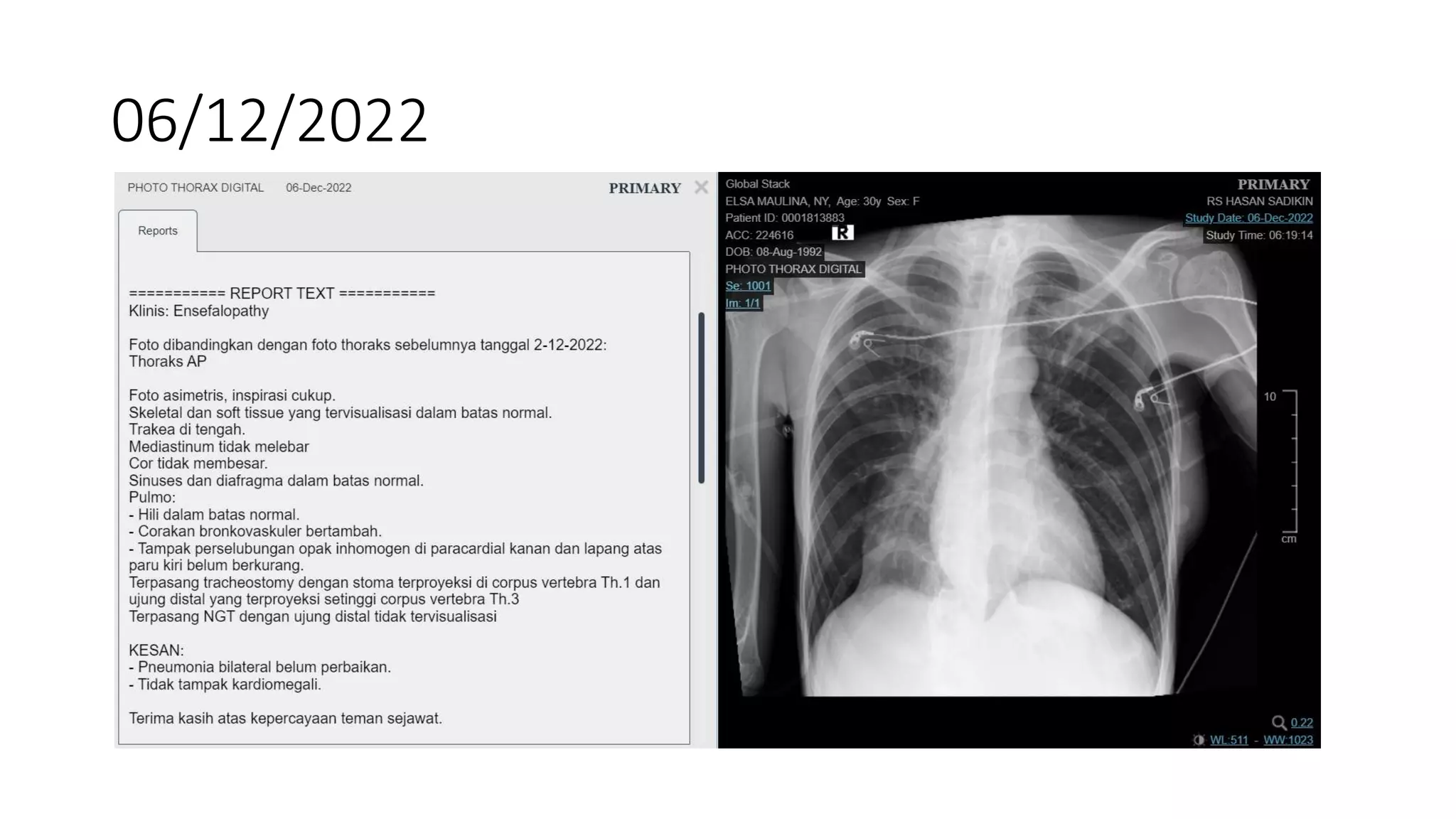 Laporan ICU 07 Des 2022 fix (1).pptx