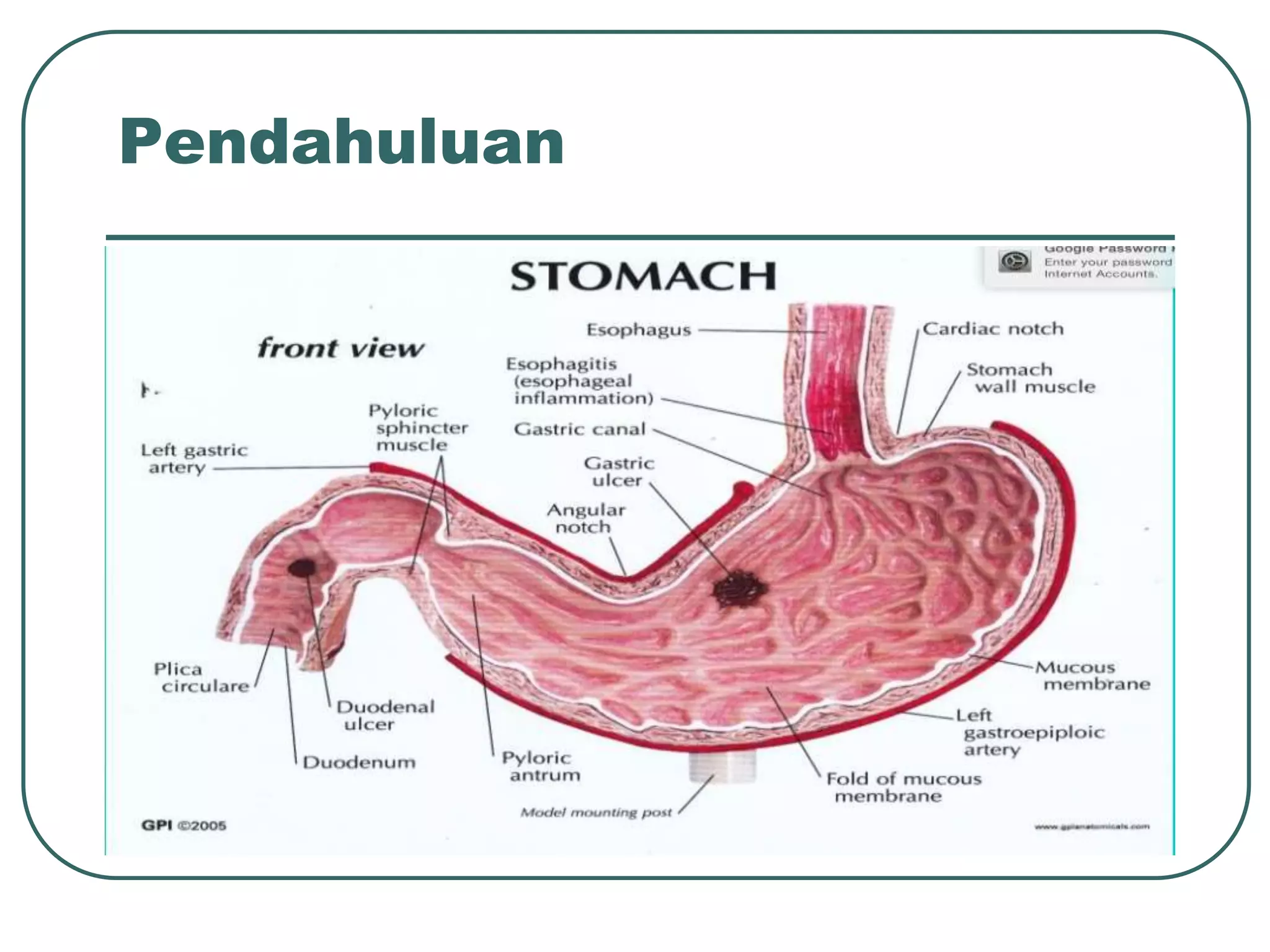 Laporan Kasus-PERFORASI GASTER.ppt