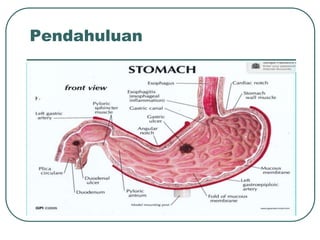 Laporan Kasus-PERFORASI GASTER.ppt