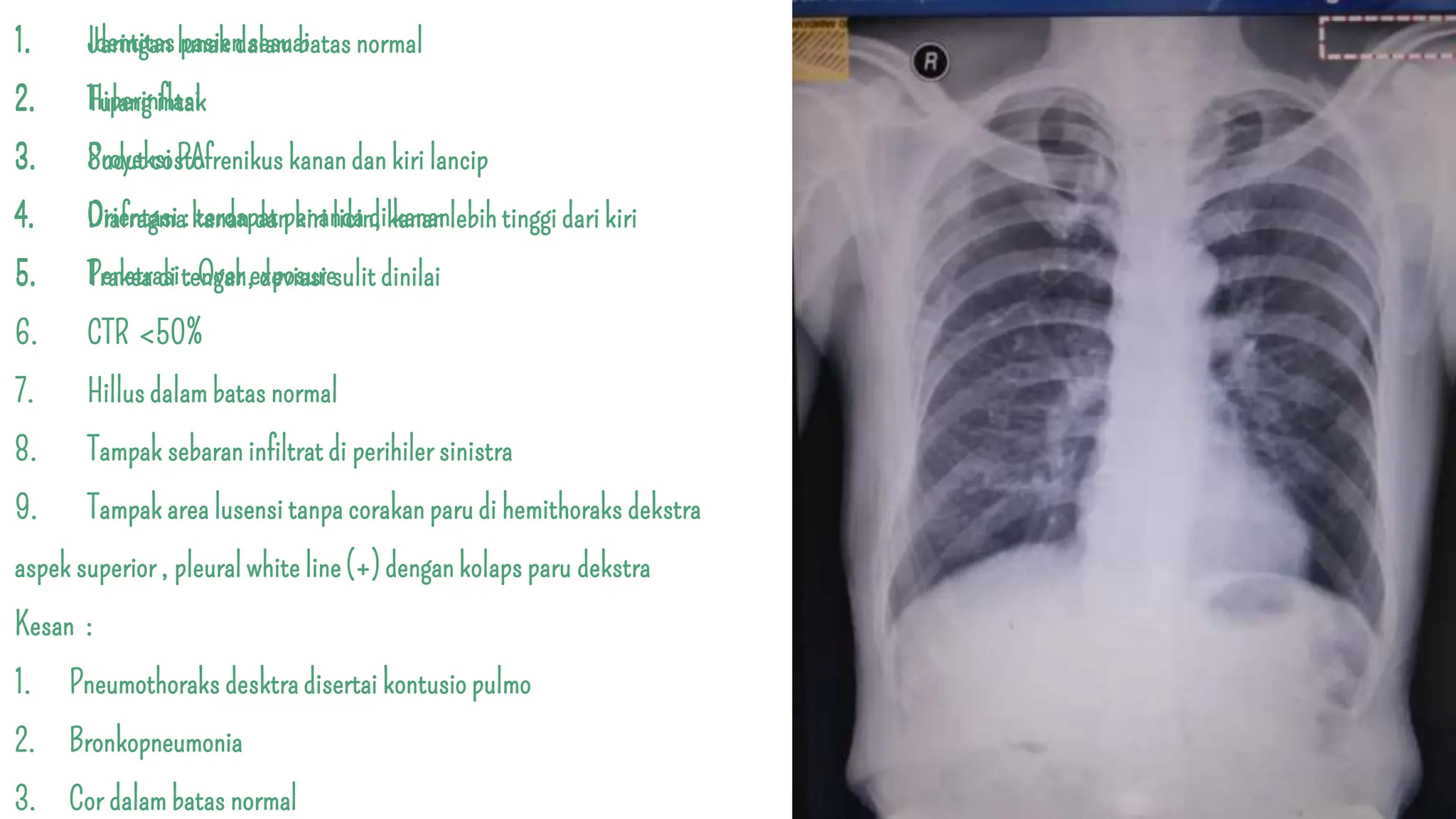 laporankasus-pneumothorax-231114120217-3822fc5b.pdf