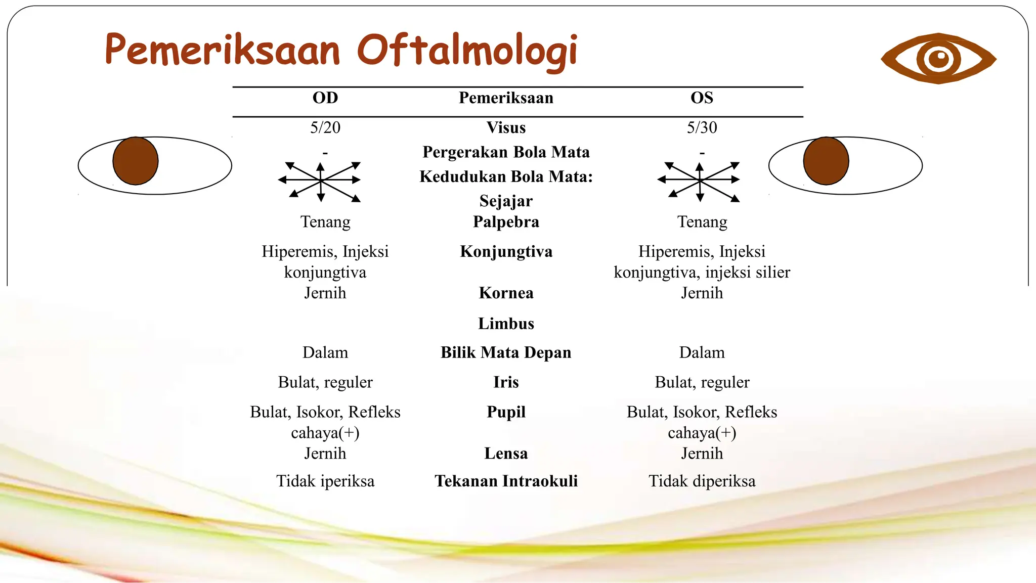 Laporan Kasus stase mata rsu zainal abidin | PPTX