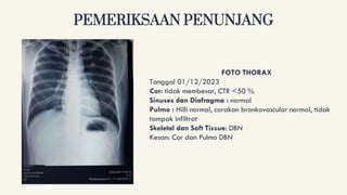 Laporan Kasus Hernia Inguinalis Lateralis | PDF