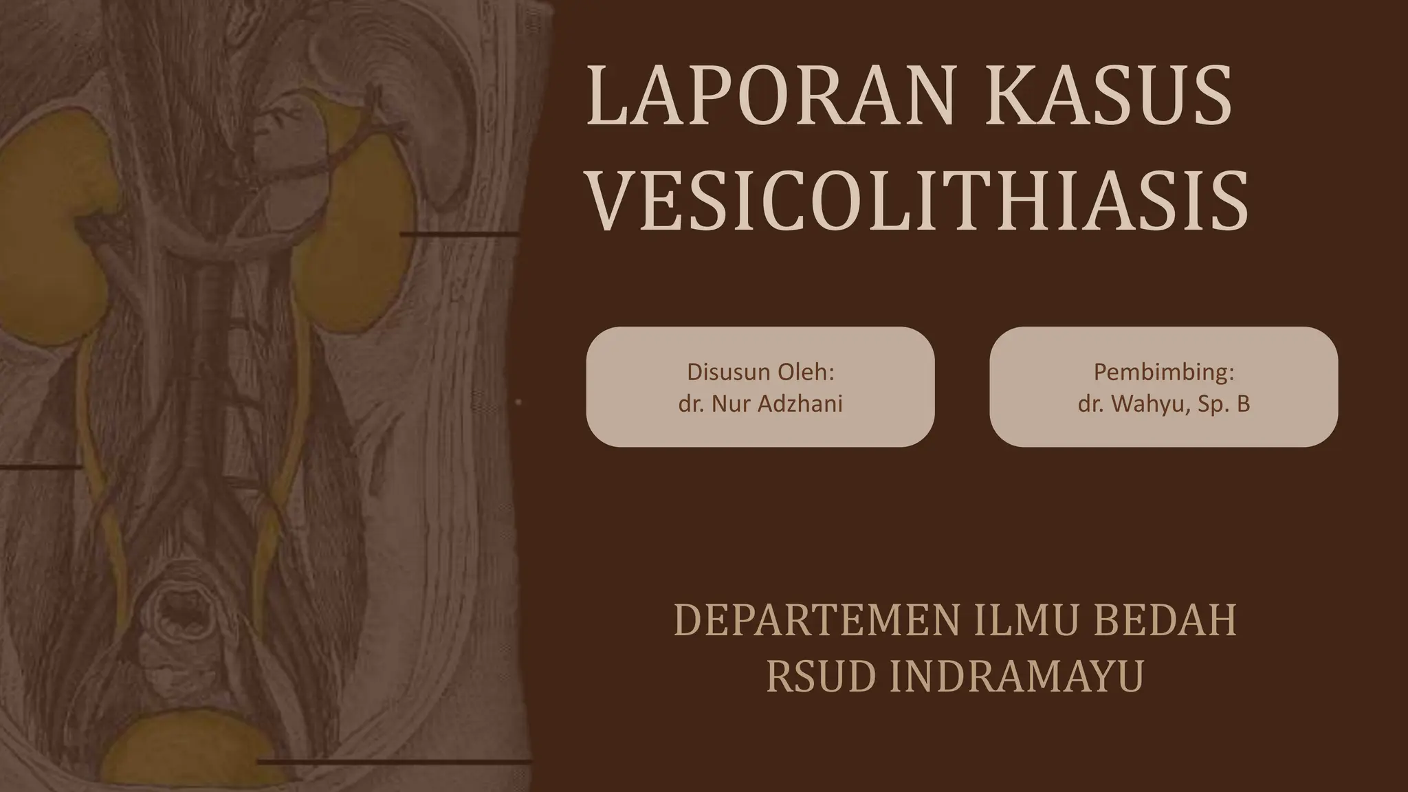 Laporan Kasus Vesicolithiasis di Rumah Sakit | PPTX