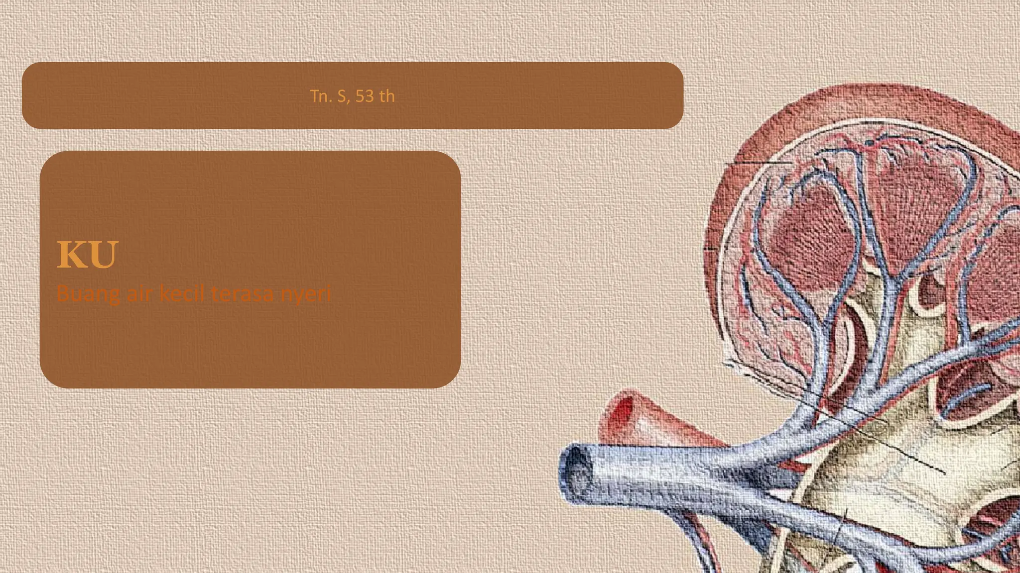 Laporan Kasus Vesicolithiasis di Rumah Sakit | PPTX