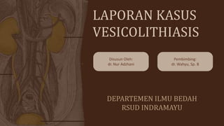 Laporan Kasus Vesicolithiasis di Rumah Sakit | PPTX