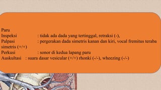 Laporan Kasus Vesicolithiasis di Rumah Sakit | PPTX