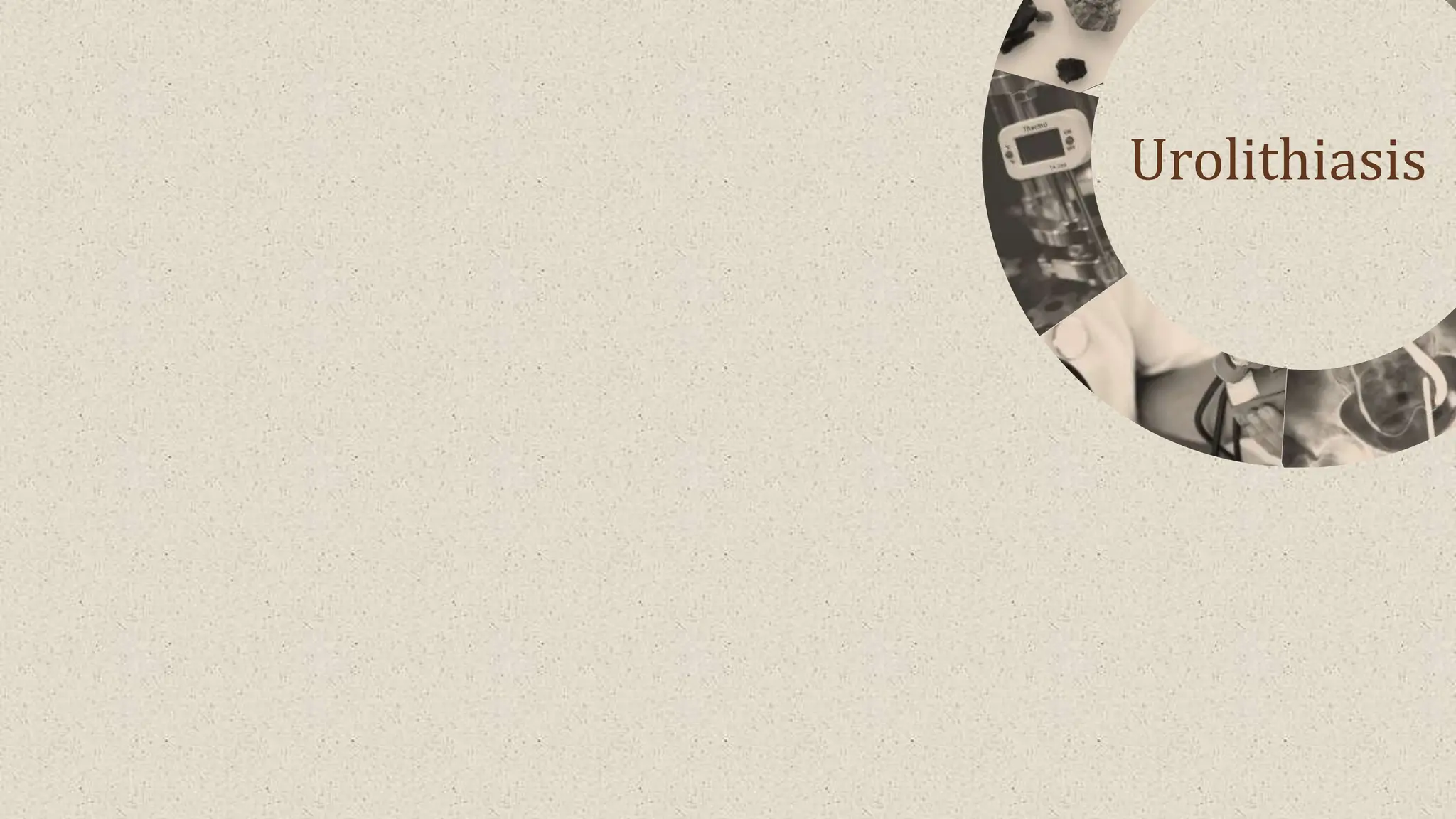 Laporan Kasus Vesicolithiasis di Rumah Sakit | PPTX